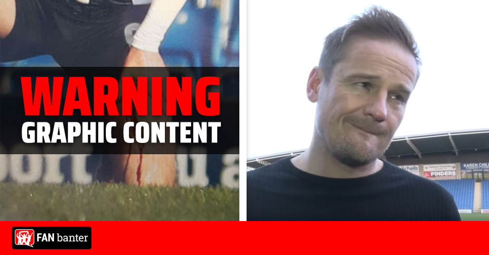 Notts County player suffers eight-inch leg gash in horror injury - Fan ...