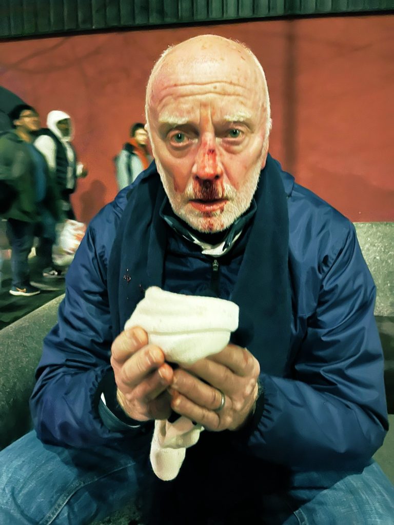 Tottenham fan and his Dad, 70, beaten up by Sheffield United fans when ...